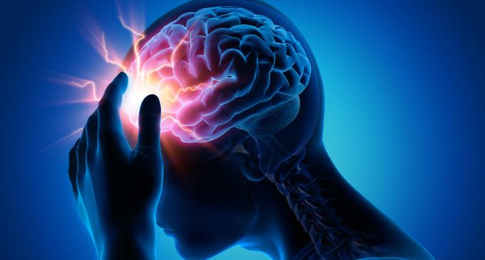 Epilessia: allo studio una cura per prevenire le crisi epilettiche